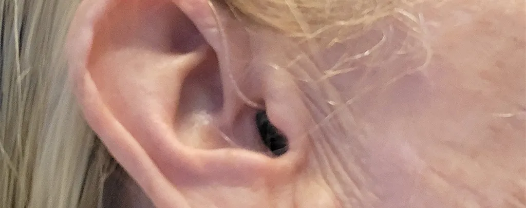 Managing Ear Wax Build-Up with Narrow Ear Canals: Do’s and Don’ts ...