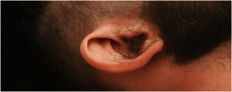 The Role of Hair Growth in Ear Wax Accumulation - Suction Ears