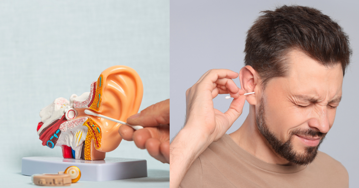 Why Cotton Buds Cause Ear Damage (And What to Do Instead) - Suction Ears